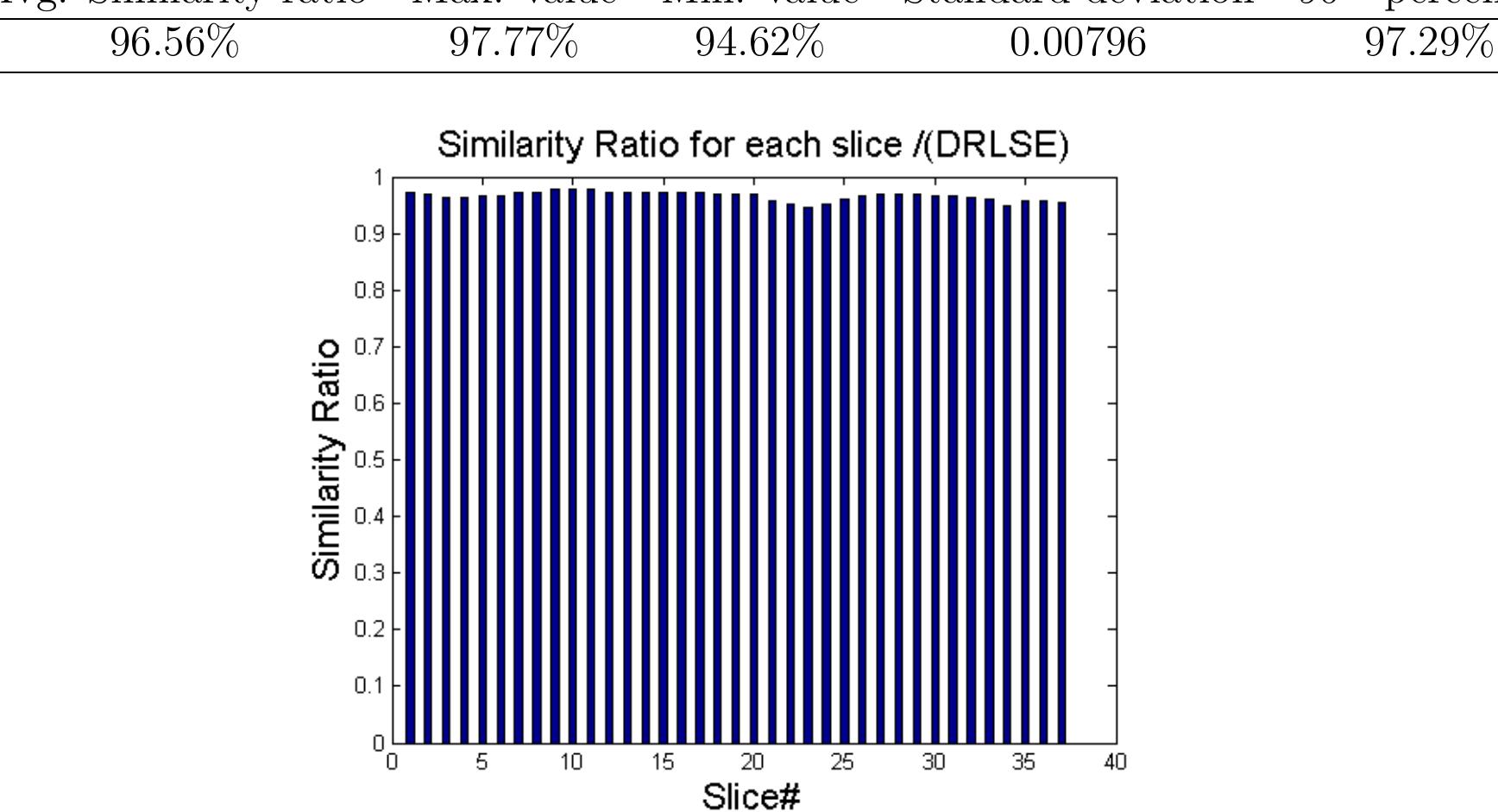 2: a histogram representing the similarity ratio slice by