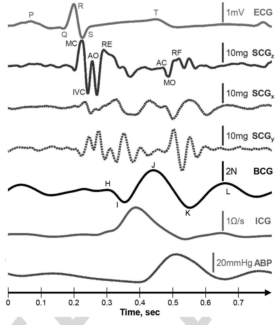 Simultaneously acquired lead ii electrocardiogram (ecg);