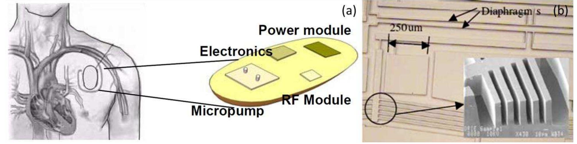 Figure 1 - from Implantable Bio-MEMS for the treatment of