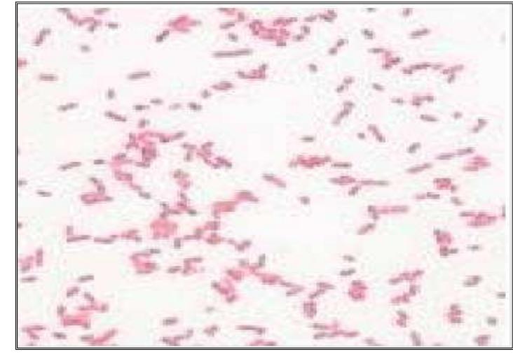 Microscopical appearance of salmonella typhi as