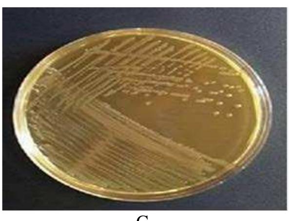 Growth of salmonella typhi on: blood agar (a), macconkey