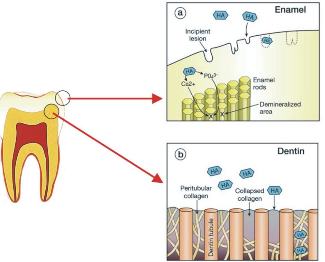 The mechanism of action of ha on the remineralisation of