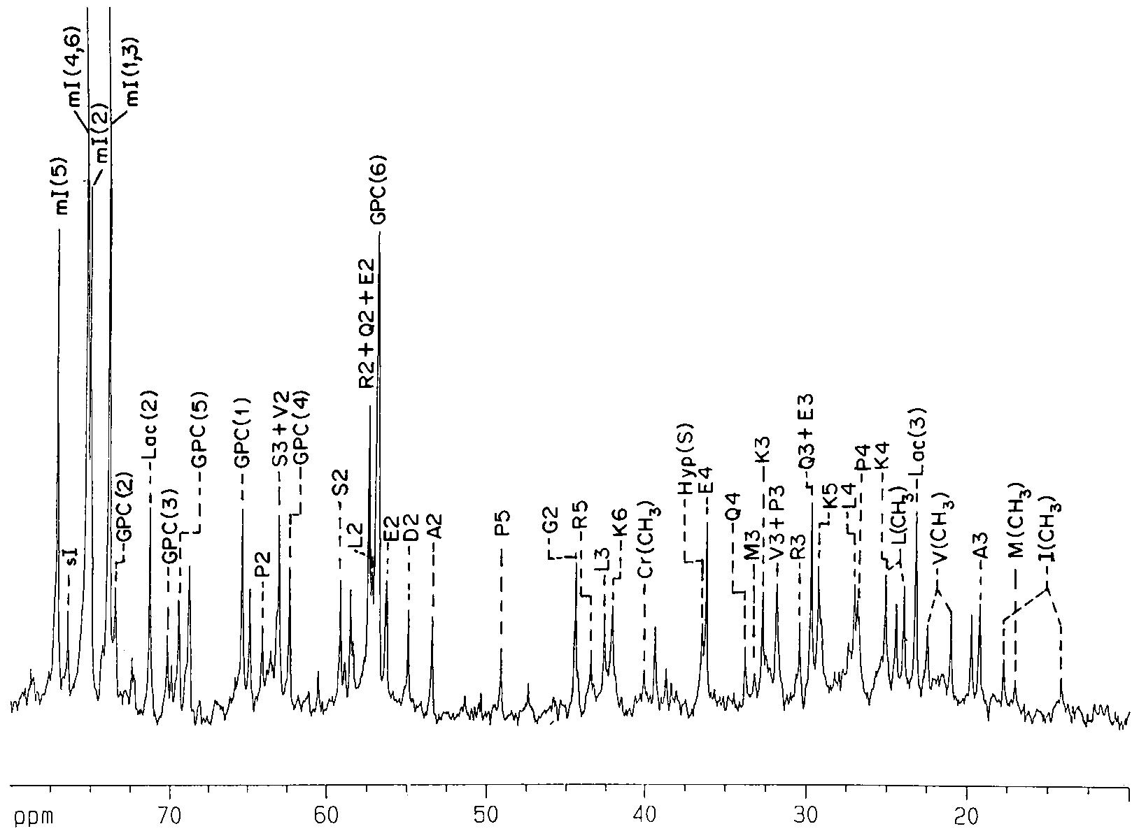 Power-gated proton-decoupled 125.76 mhz “c nmr spectrum of