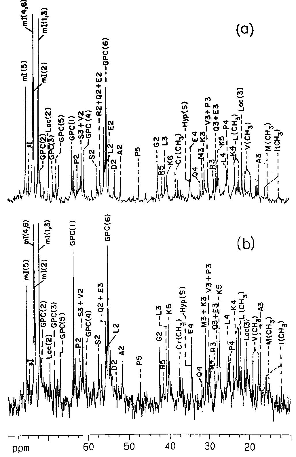 Power-gated proton-decoupled "*c nmr spectra of (a) ef and
