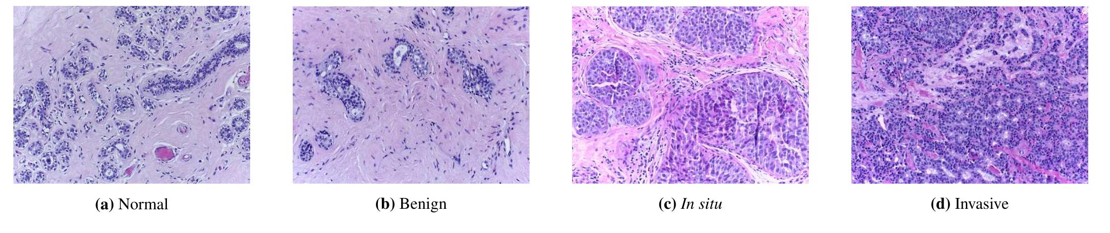 Examples of microscopy images from the bach dataset.