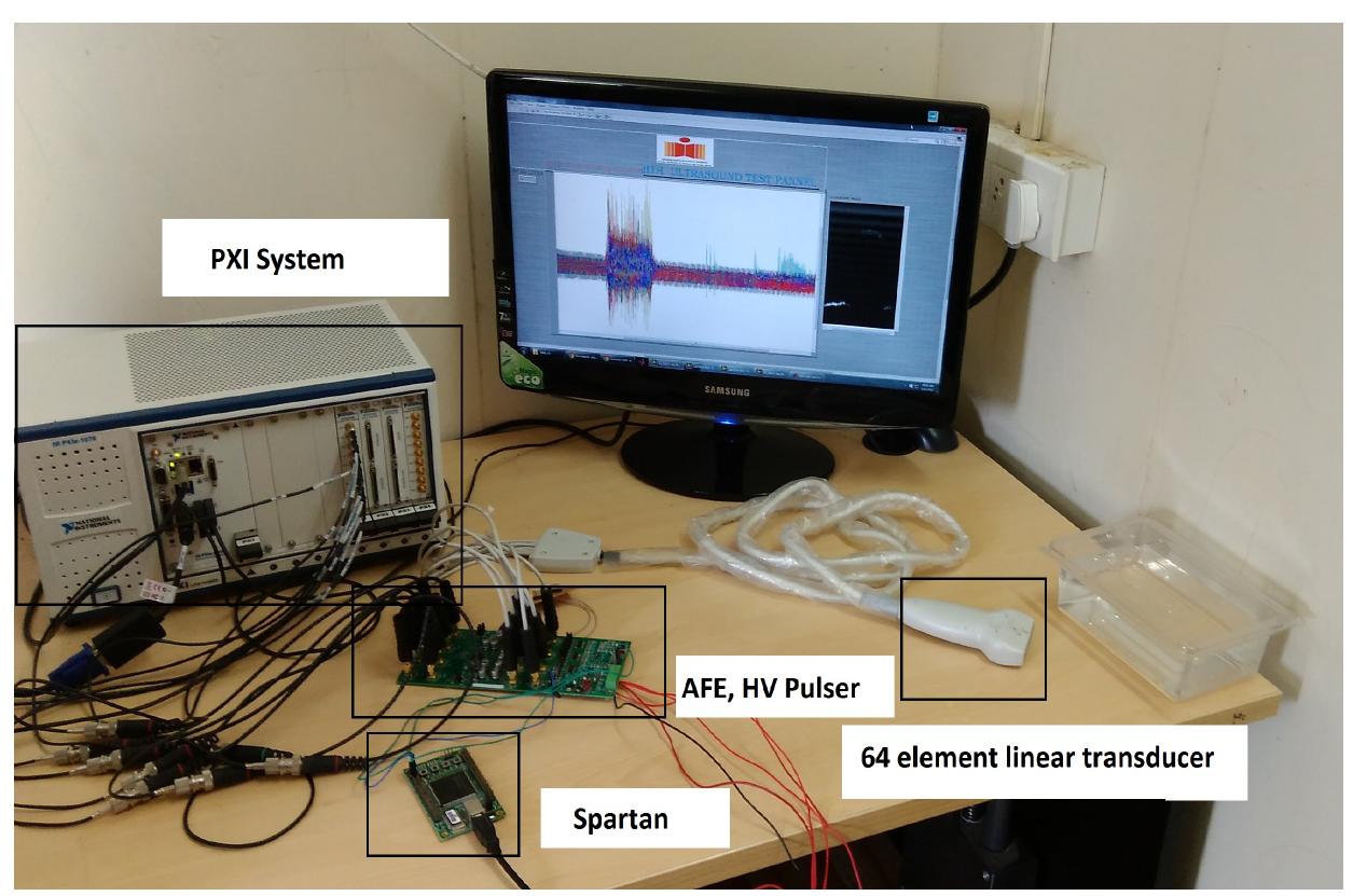 Figure 16 - FPGA-Based Portable Ultrasound Scanning System