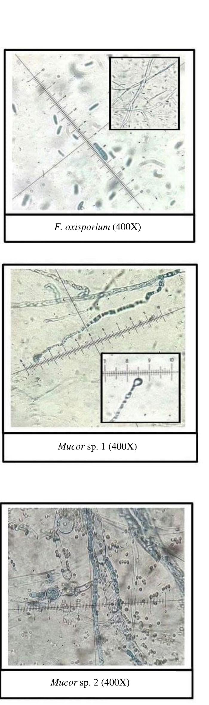 Figure 7 - Isolation and identification of some fungi from