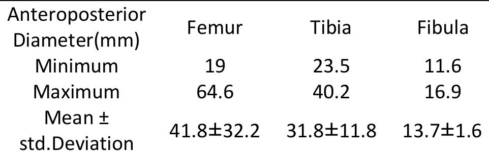 Table 3 - Evaluation of Nutrient Foramen of the Femur,