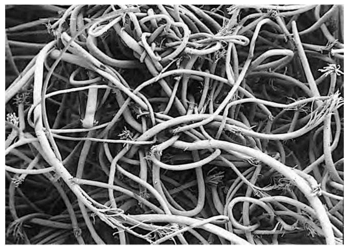 6. scanning electron micrograph of a replica of the