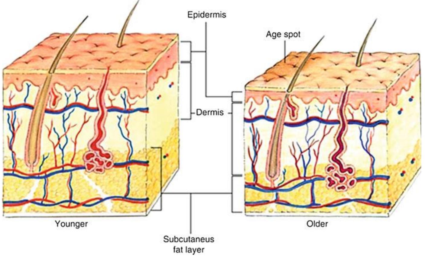 Figure 2 - Anatomy and Histologic of Intrinsic Aging Skin