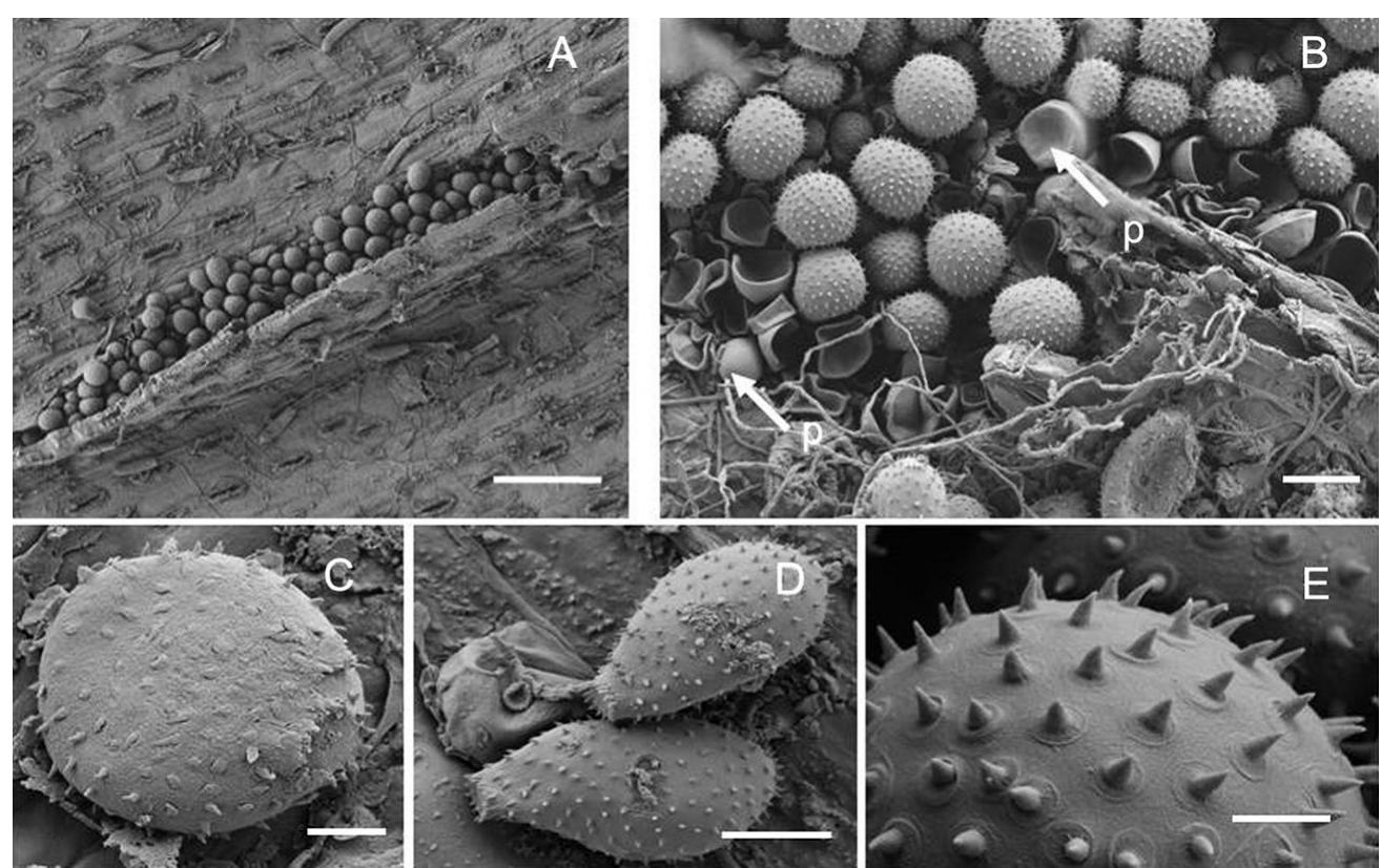 - scanning electron microscope images of pustules and spores
