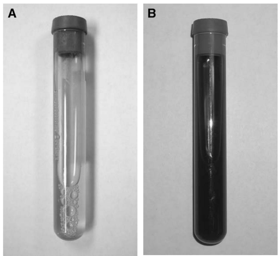 (a) urine sample obtained from a 3-month-old female