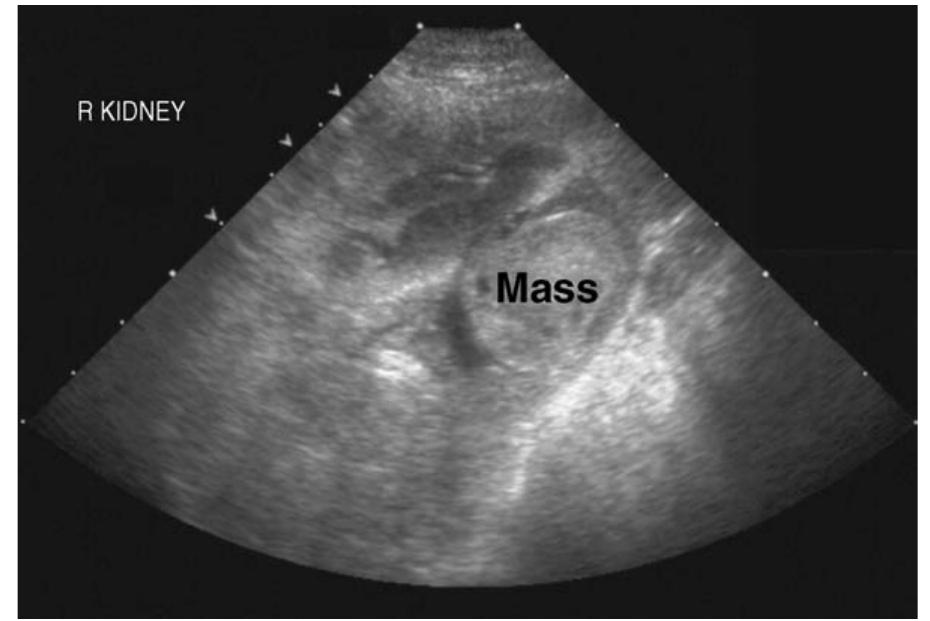 Abdominal ultrasound of 7-year-old male labrador retriever