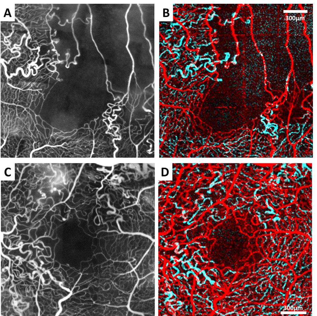 Ficure 10. visualization of the superficial and deep