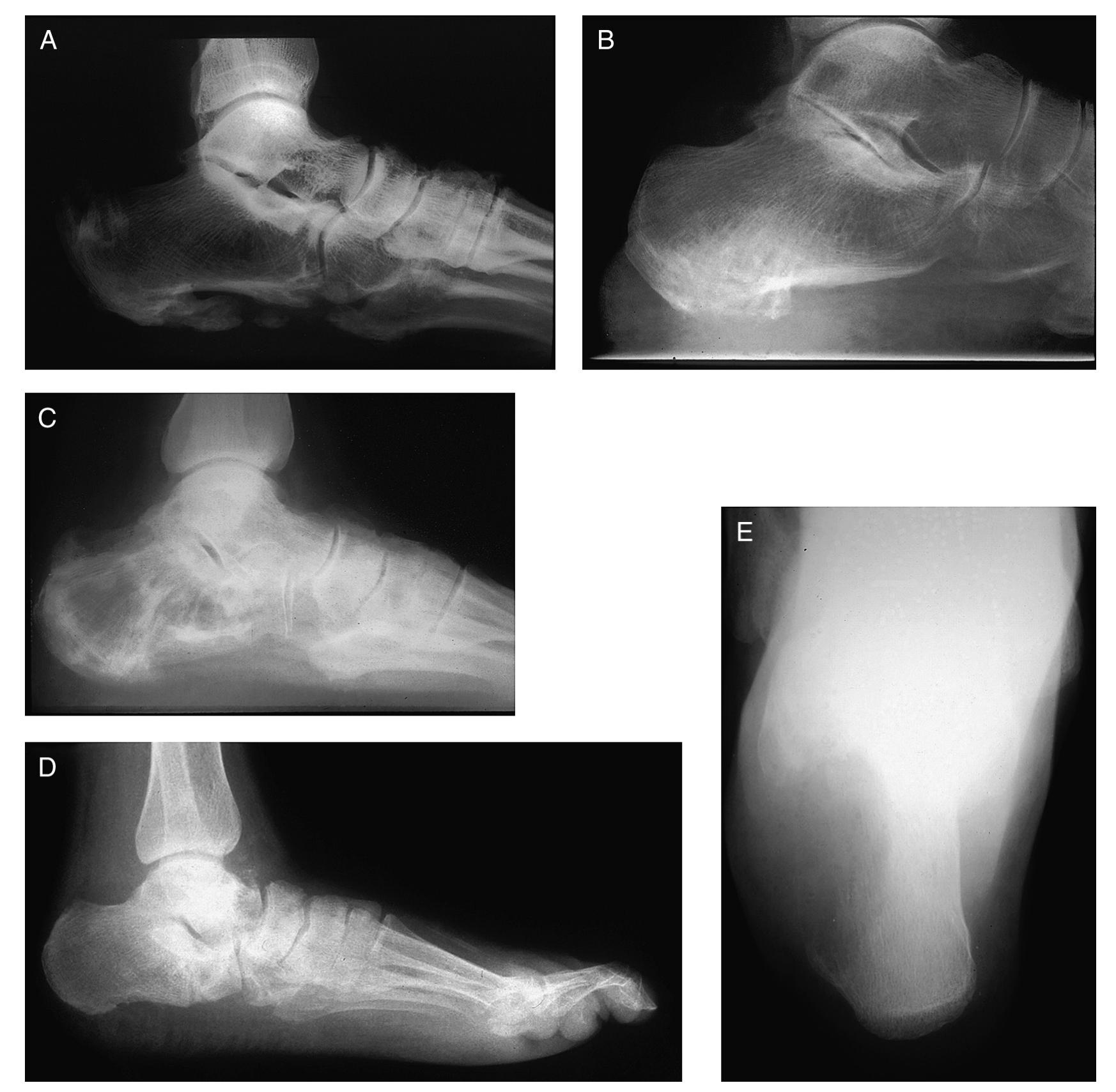 As depicted in these radiographs, very diverse pathologies