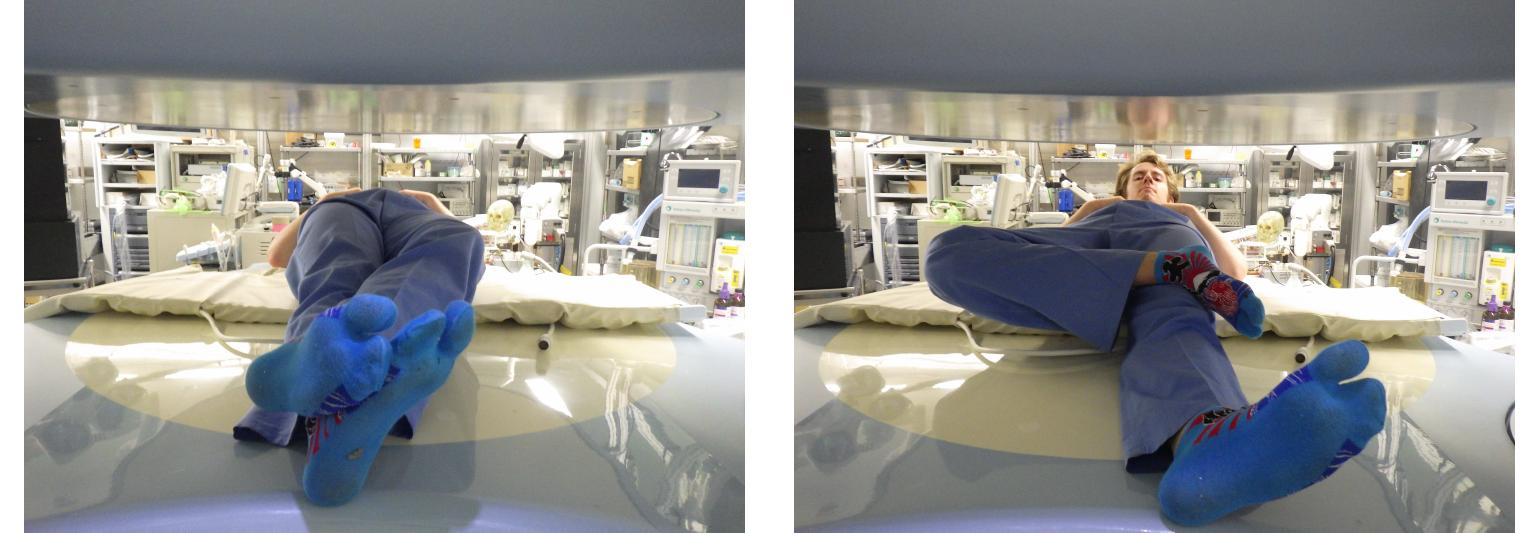 3: functional poses imaged using open-gantry mri. the