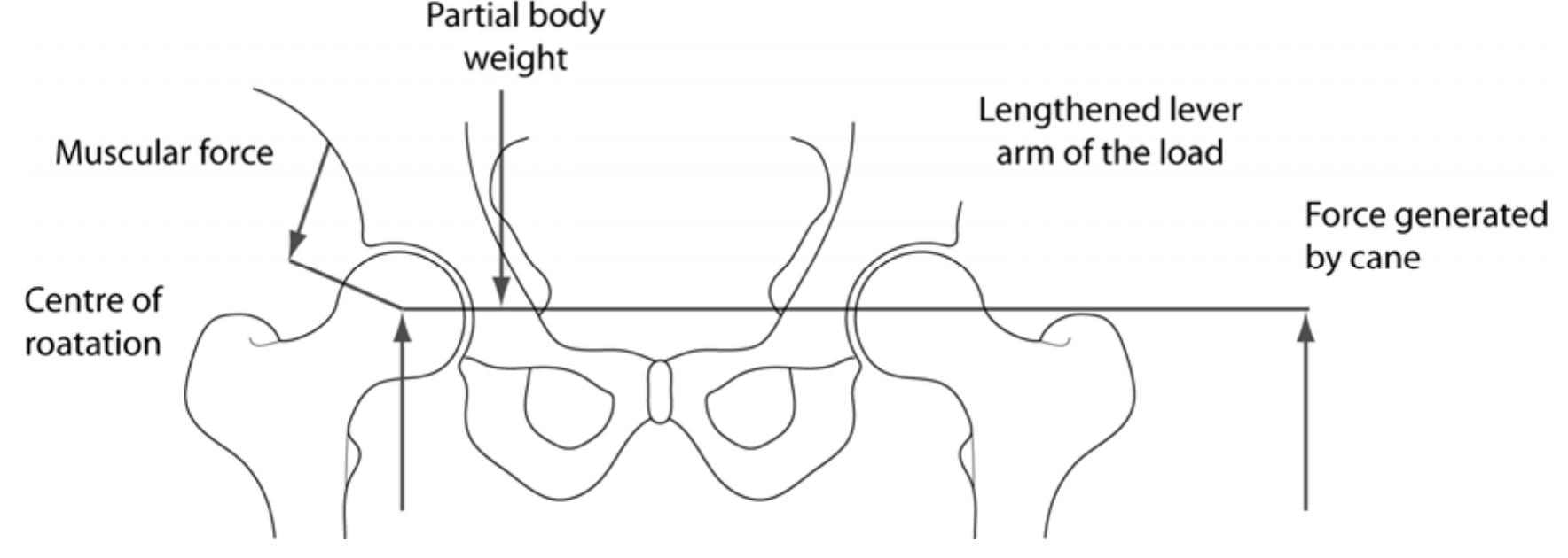 Normally the tissues and bones of the hip joint function
