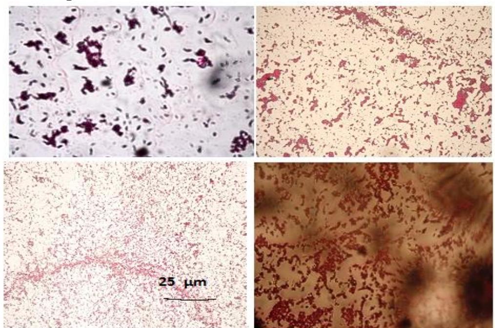 Four bacteria s1, s2, s3 and s5 were gram positive.