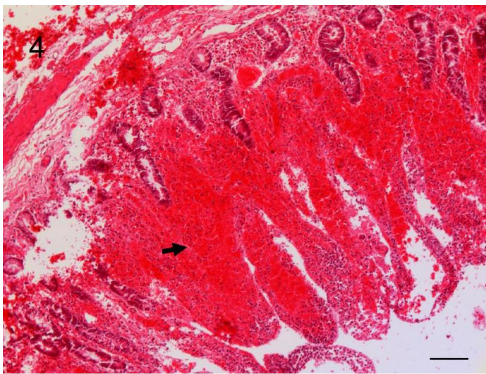 Small intestine, histopathology. diffuse mucosal and