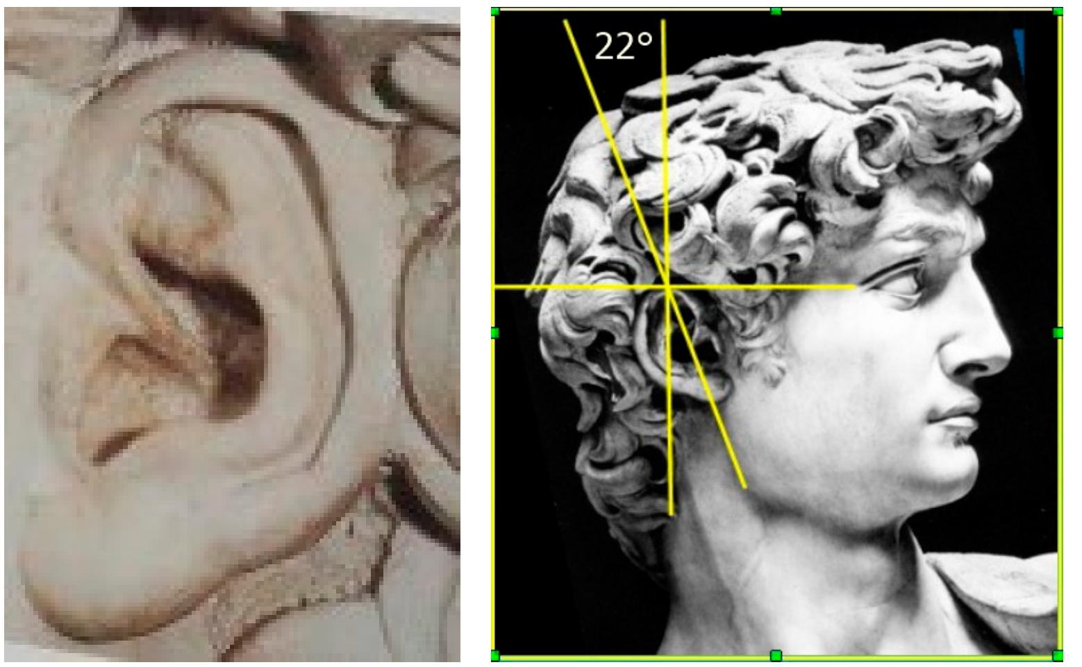 The left ear of david. fig. 4. lateral view of david's head
