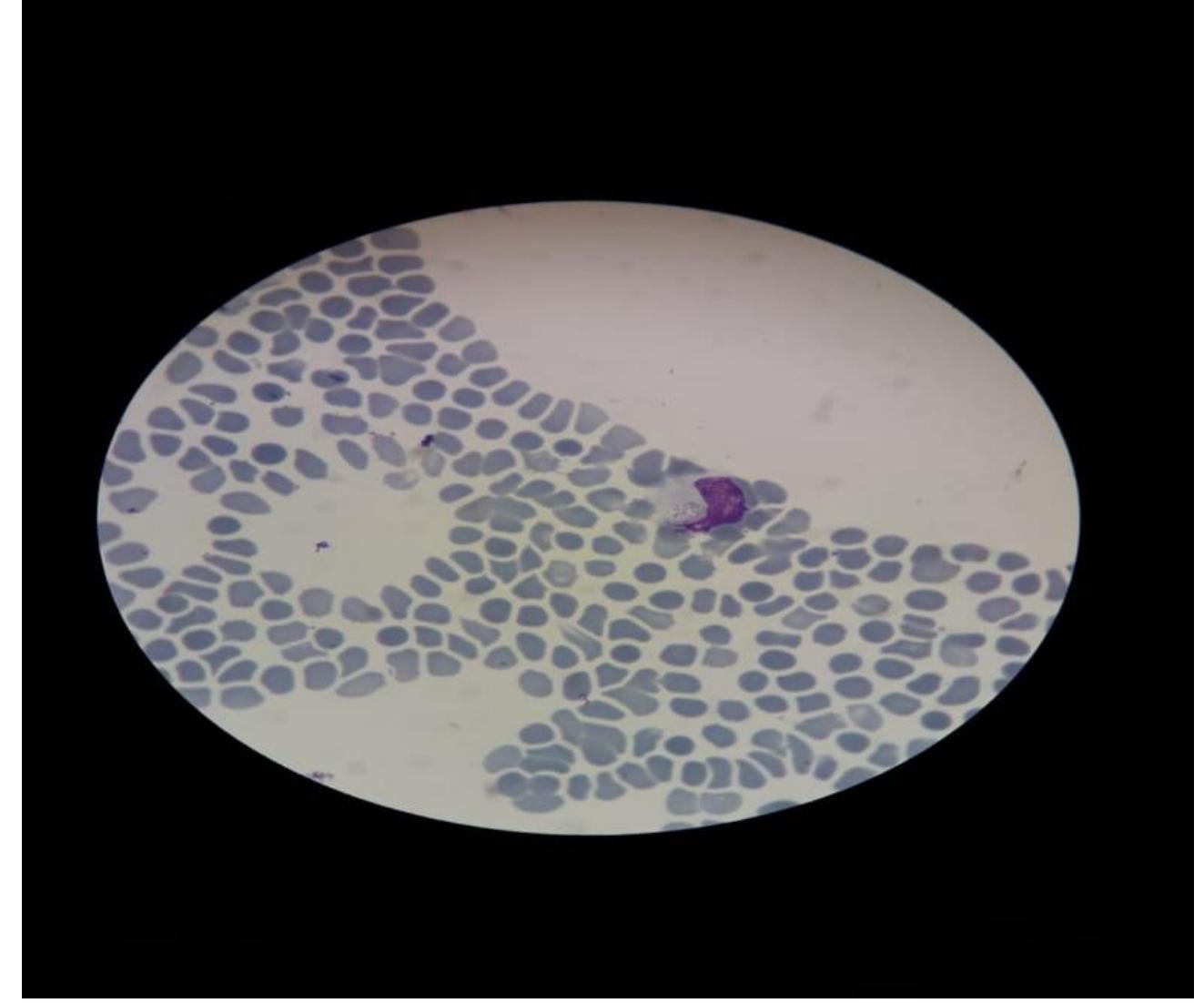 Ehrlichia canis morula (arrow) in monocyte (giemsa stain)