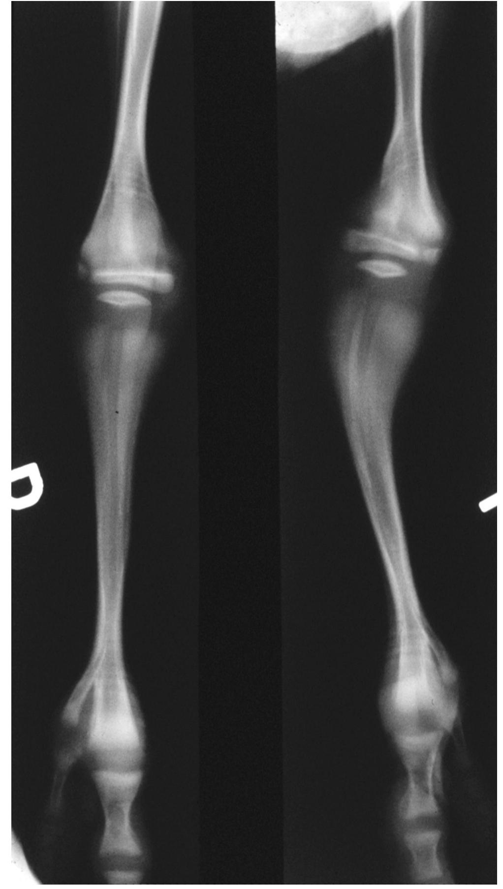 5 angular limb deformity in an ostrich. radiographs of the