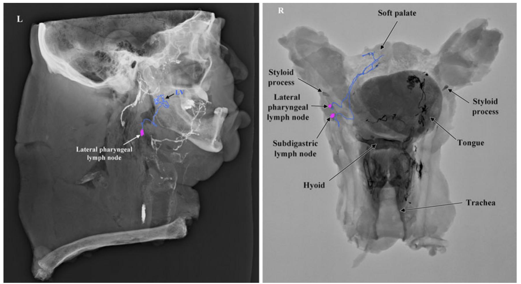 (left) radiograph (medial view) of the medial side of the