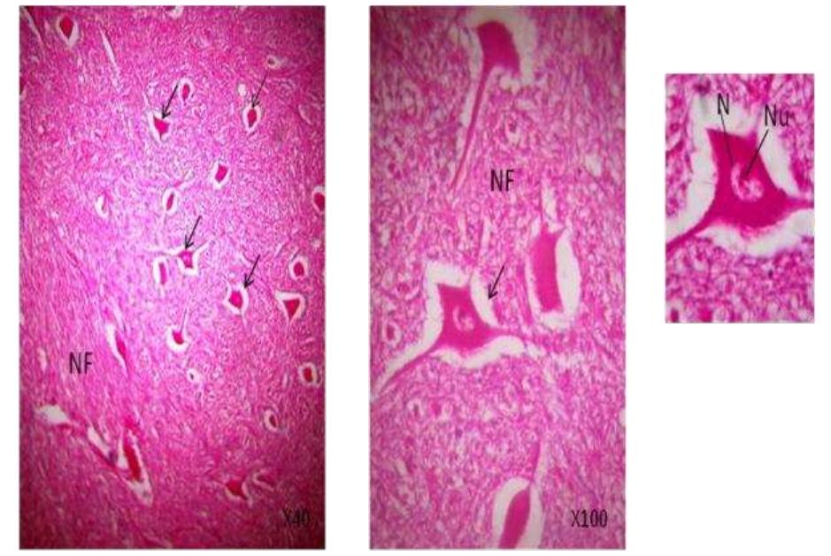 5 photomicrograph of the dpx mounted mallory azan stained