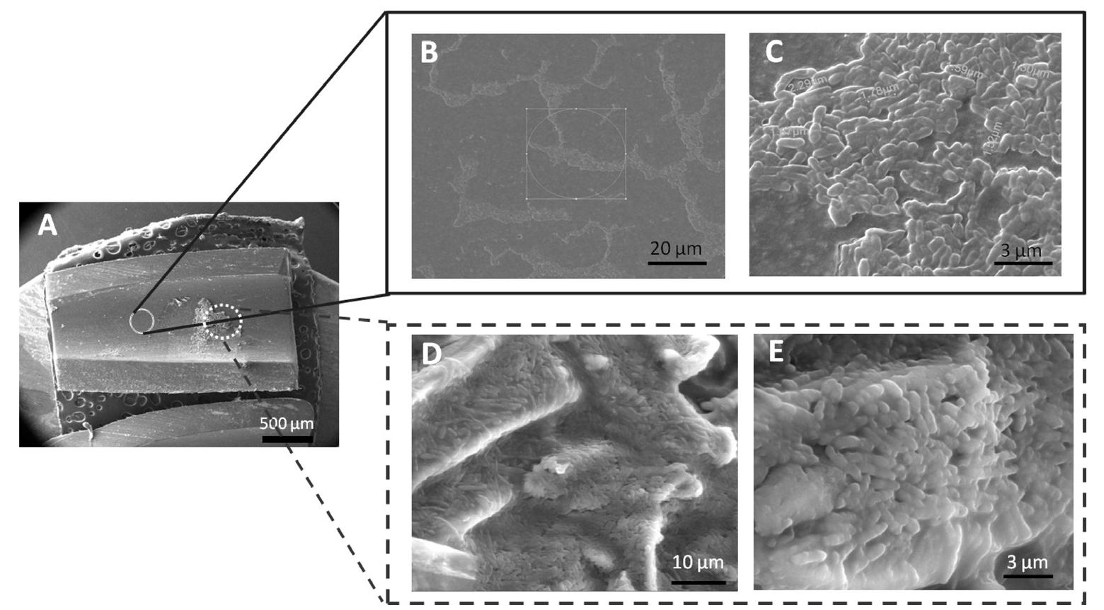 Scanning electron microscopy (sem) images of the clogged