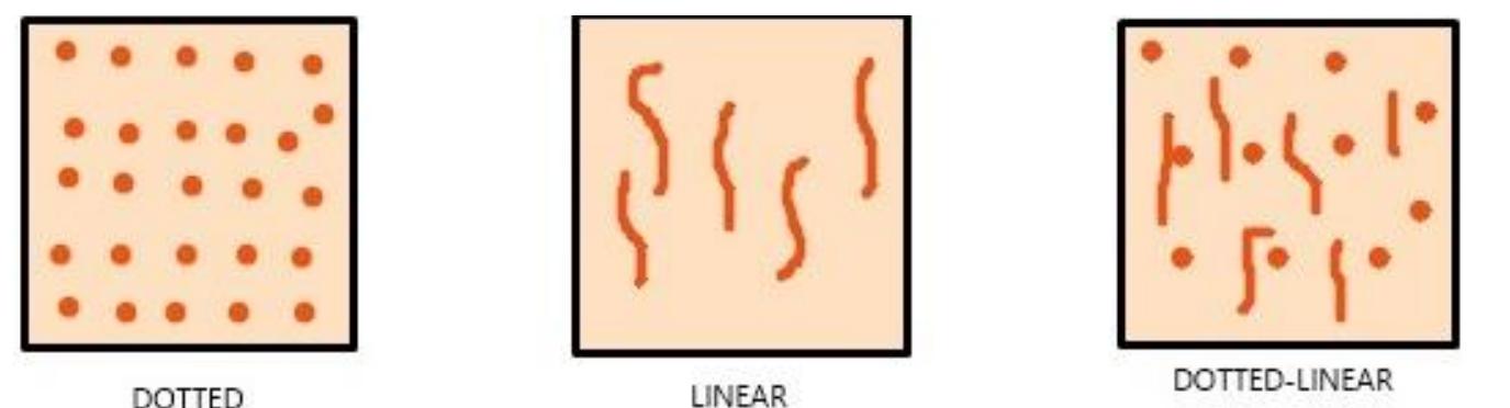 Types of vessels (schematic diagram showing vascular