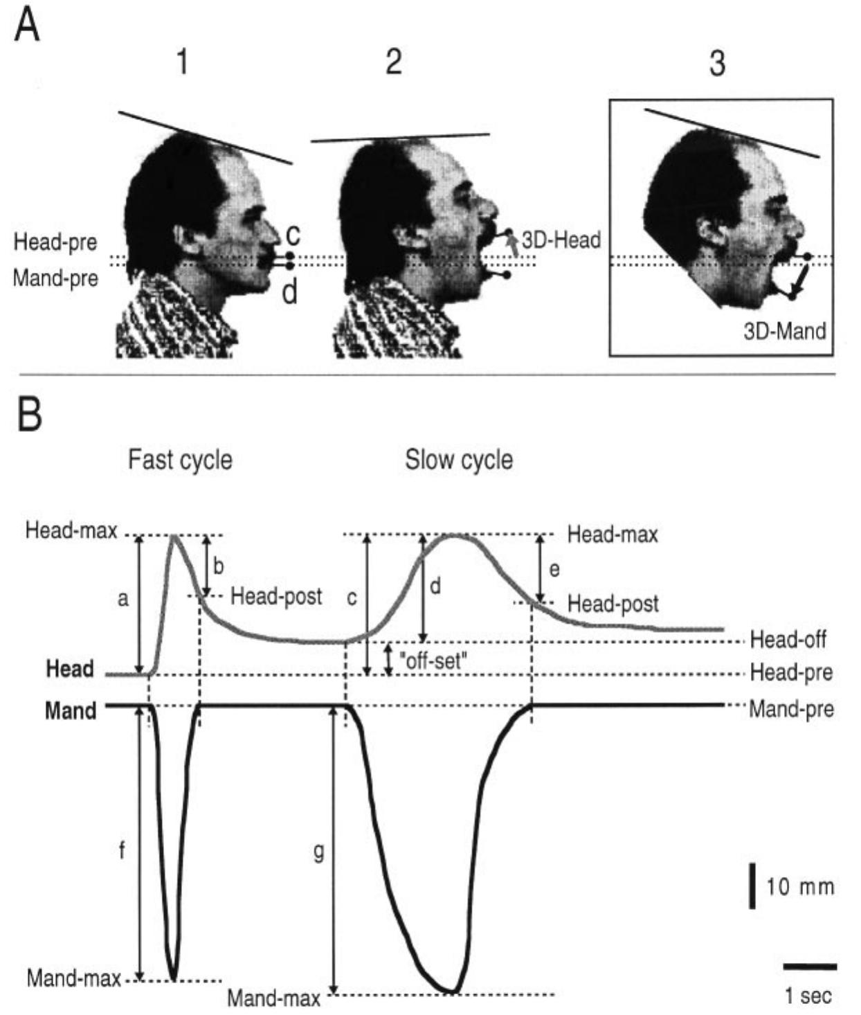 A: illustration of head (3d-head, arrow in 2) and mandibular