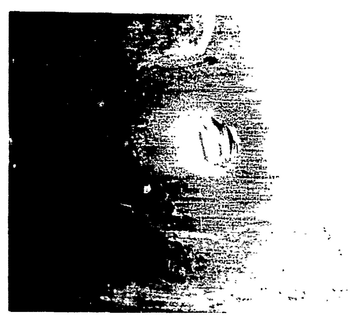 Macrograph of the retention band surface where an attachment