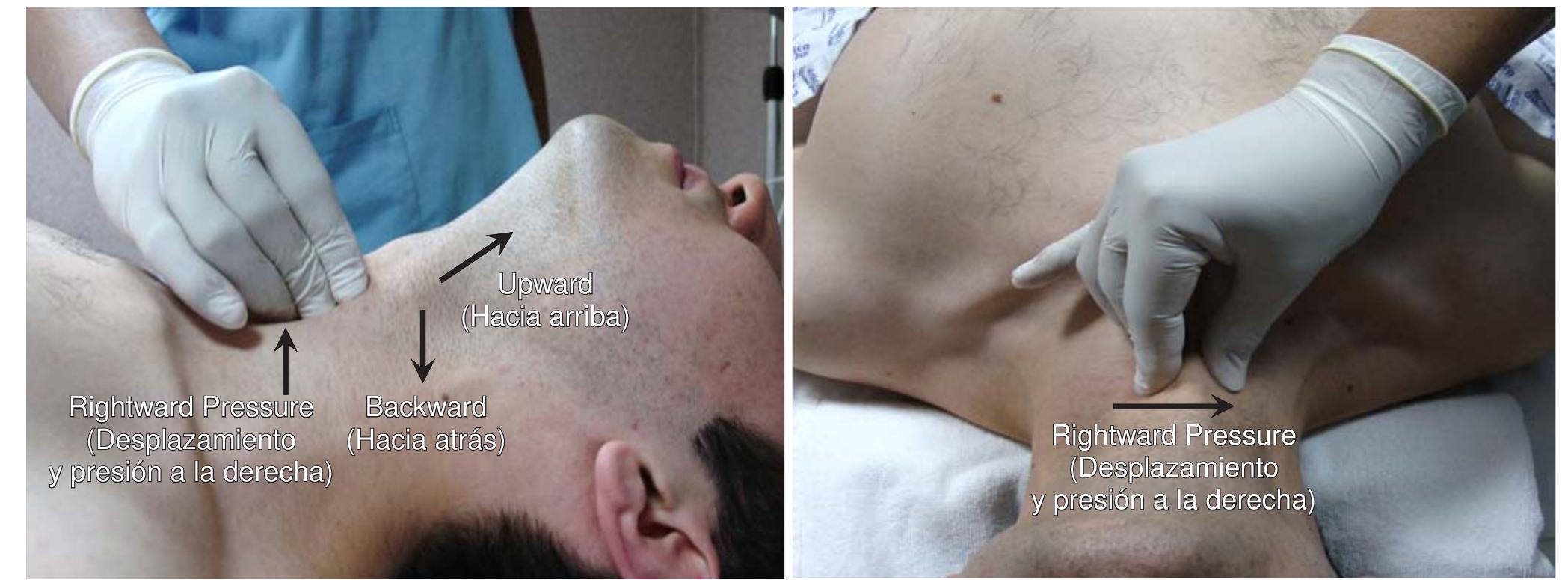 (PDF) The BURP maneuver