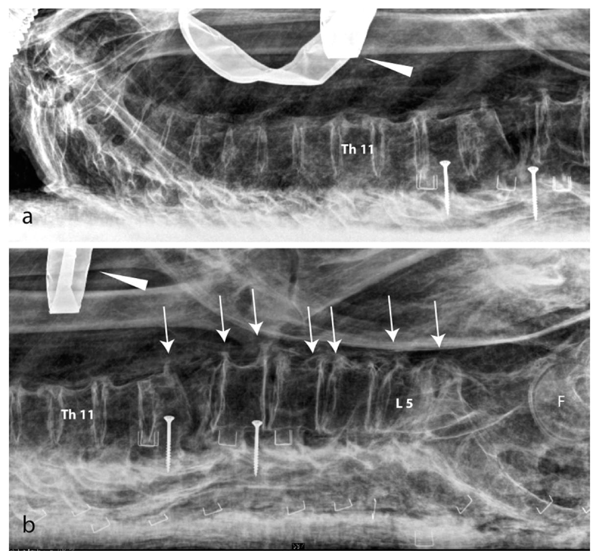 Kha. lateral view of the thoracic (a) and lumbar (b) spine.