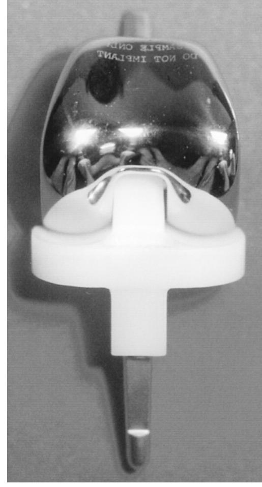 The stabilocondylar prosthesis was one of the first