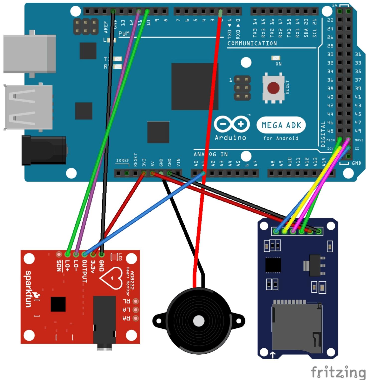 Figure 2 - from An Arduino based heartbeat detection device