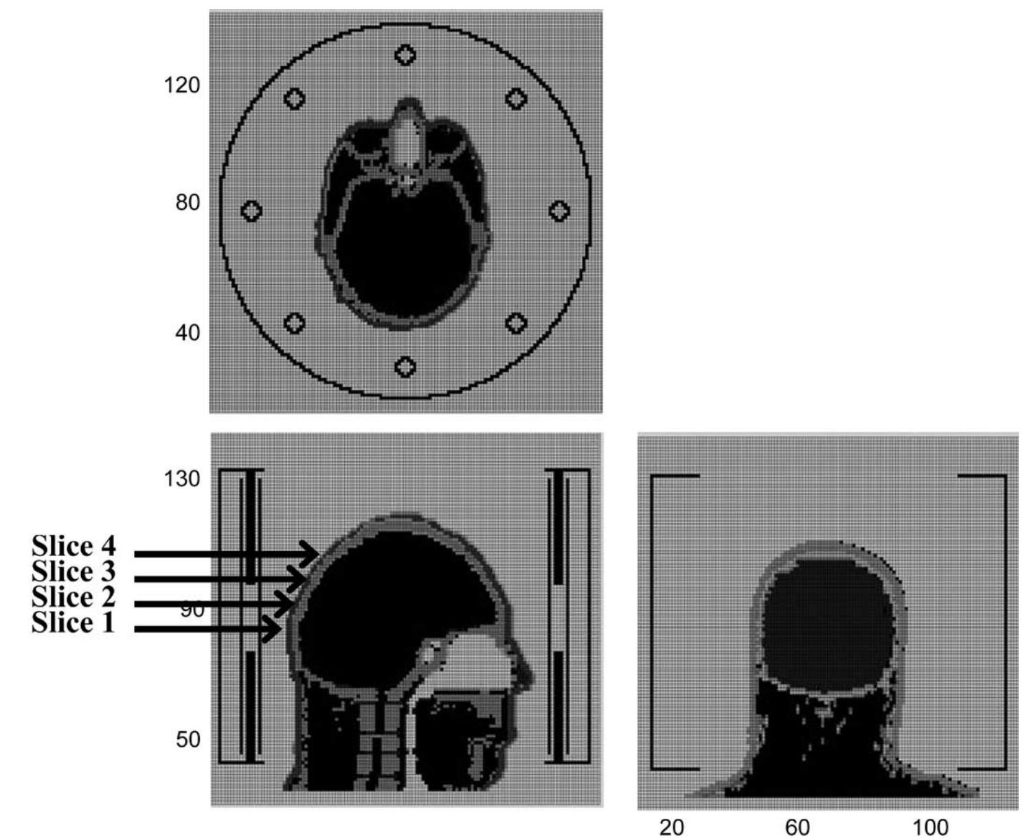 Axial, sagittal, and coronal slices of an eight-strut tem