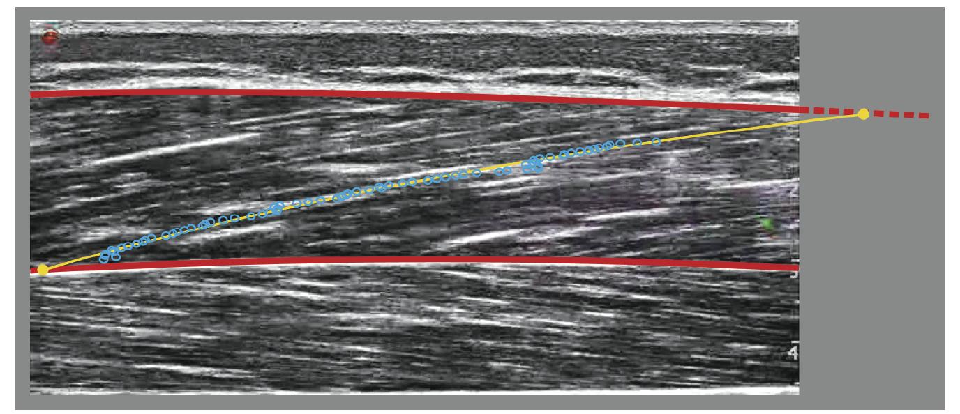 -8: ultrasound image of the vastus lateralis muscle in the