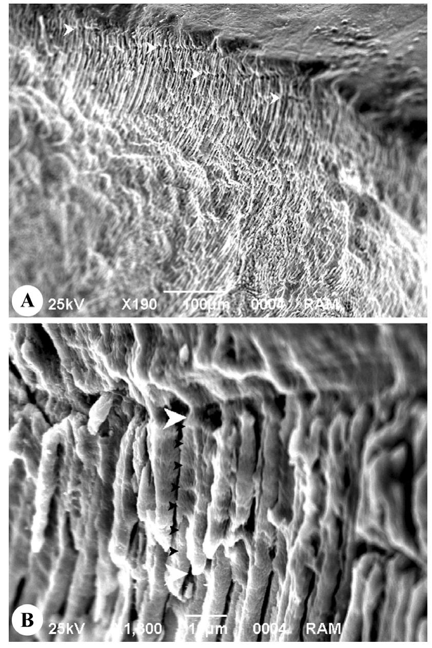 (a) enamel microstructure as seen in a cross- section on the