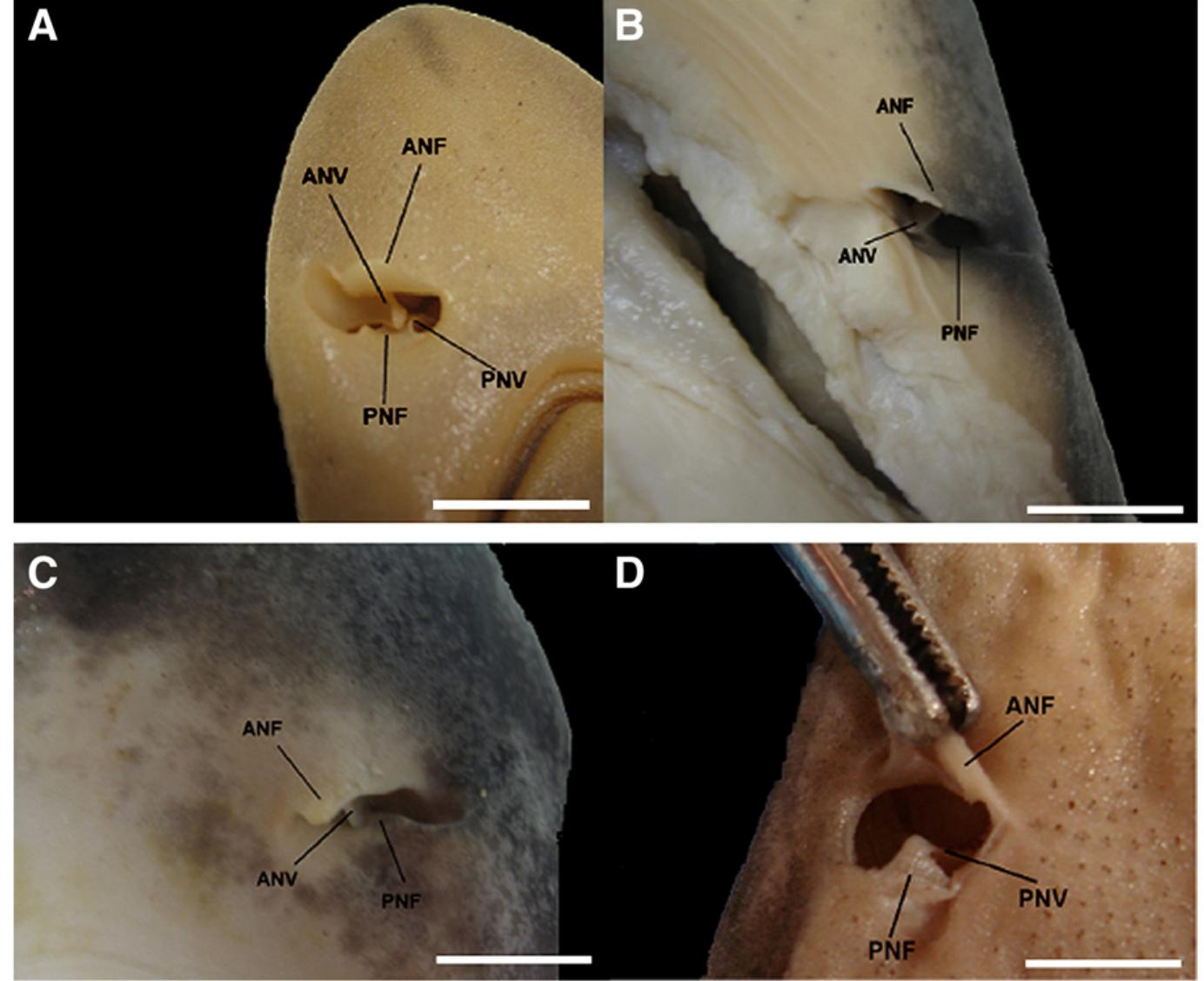 Illustration of anterior and posterior nasal valve(s) in (a)