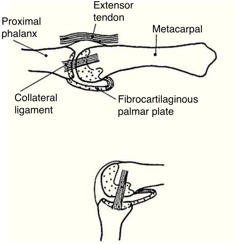 Upper panel. mcp joint showing the metacarpophalangeal joint