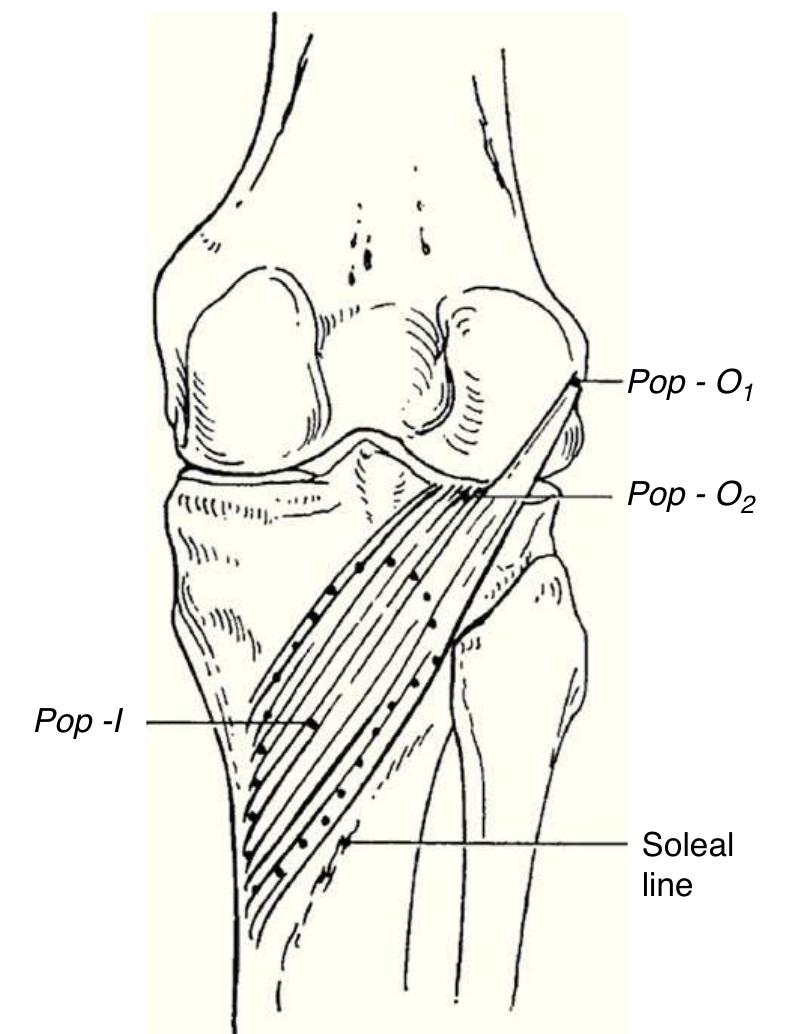Popliteus muscle. two insertions are shown, in the lateral
