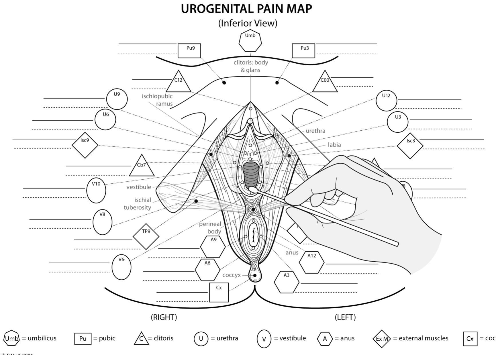 urogenital pain map (map 1), identifying external points