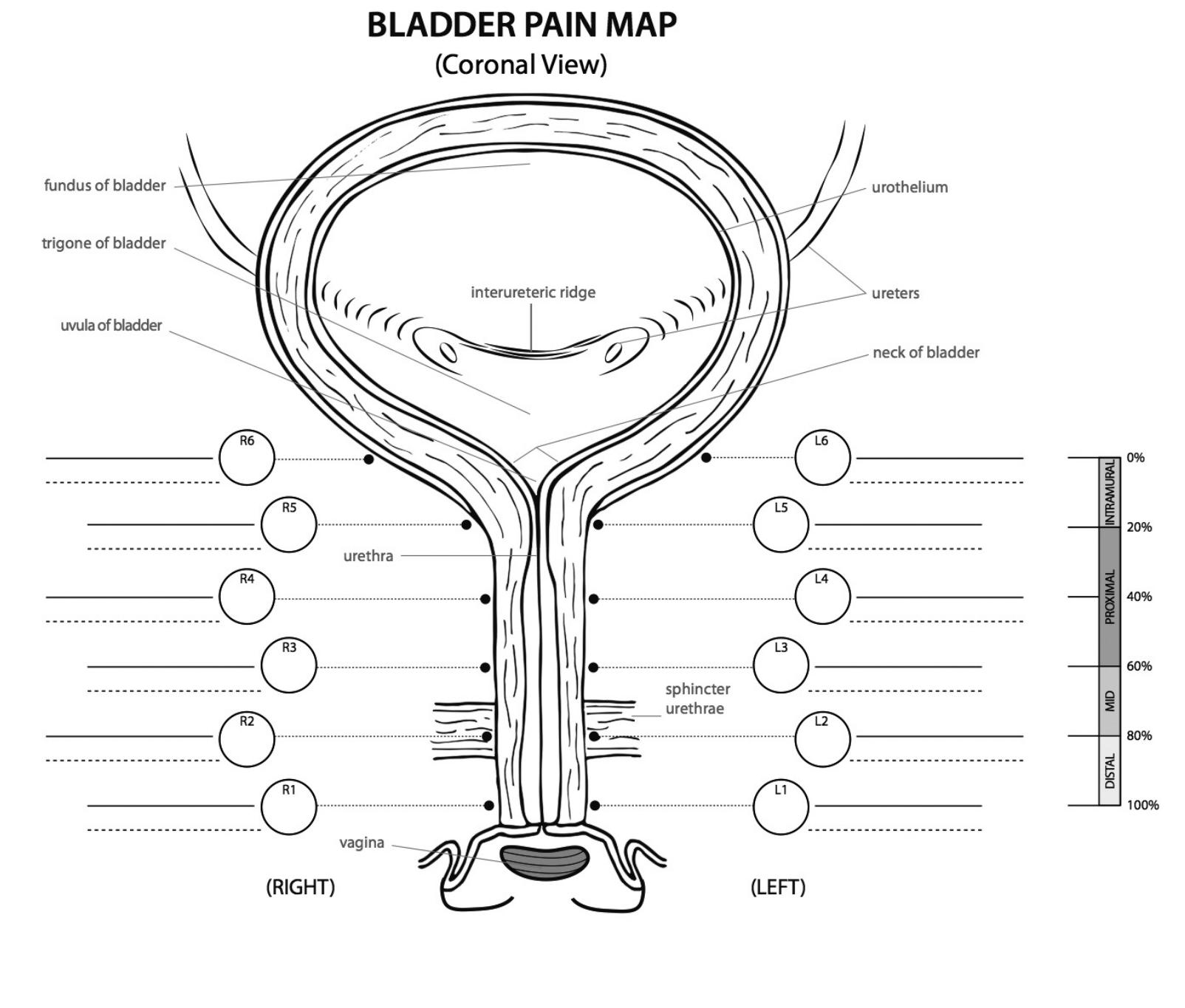 Figure 5 - from Mapping chronic urogenital pain in women: