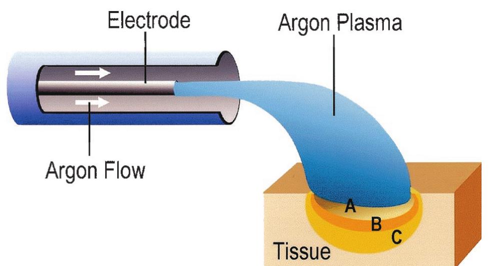 Ficuree 1. schematic representation of a section of the apc