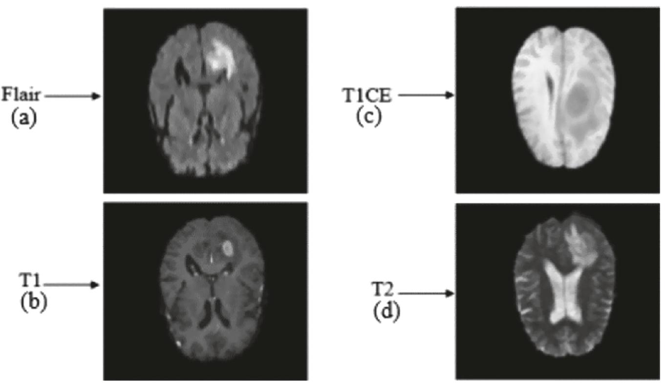 | shows typical types of mri. in the images of (a), the