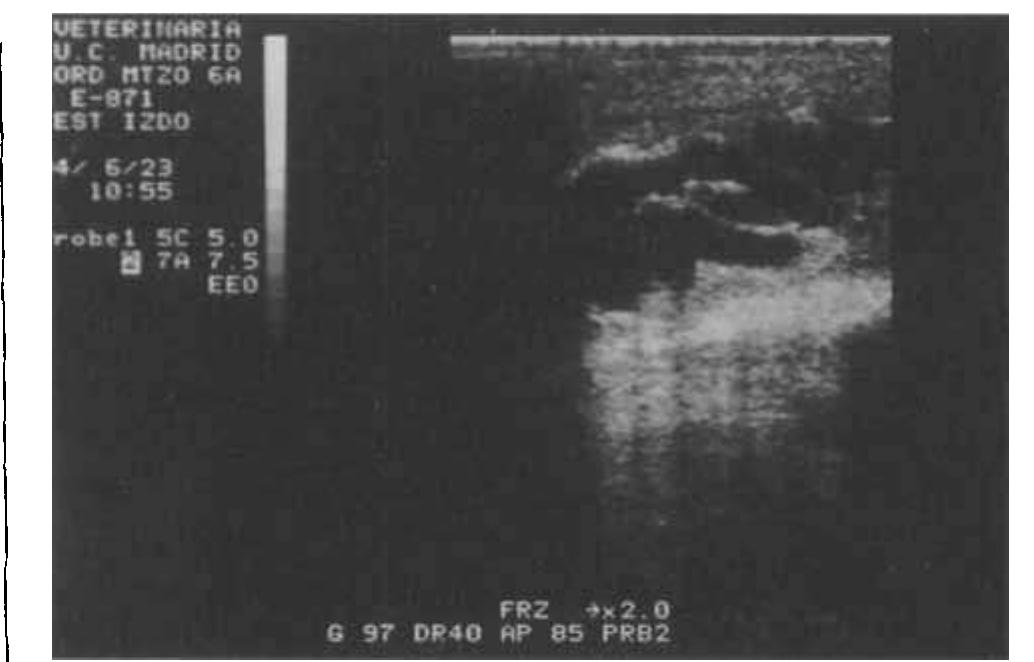 Ultrasound image of the left testicle. the tortuou: anechoic