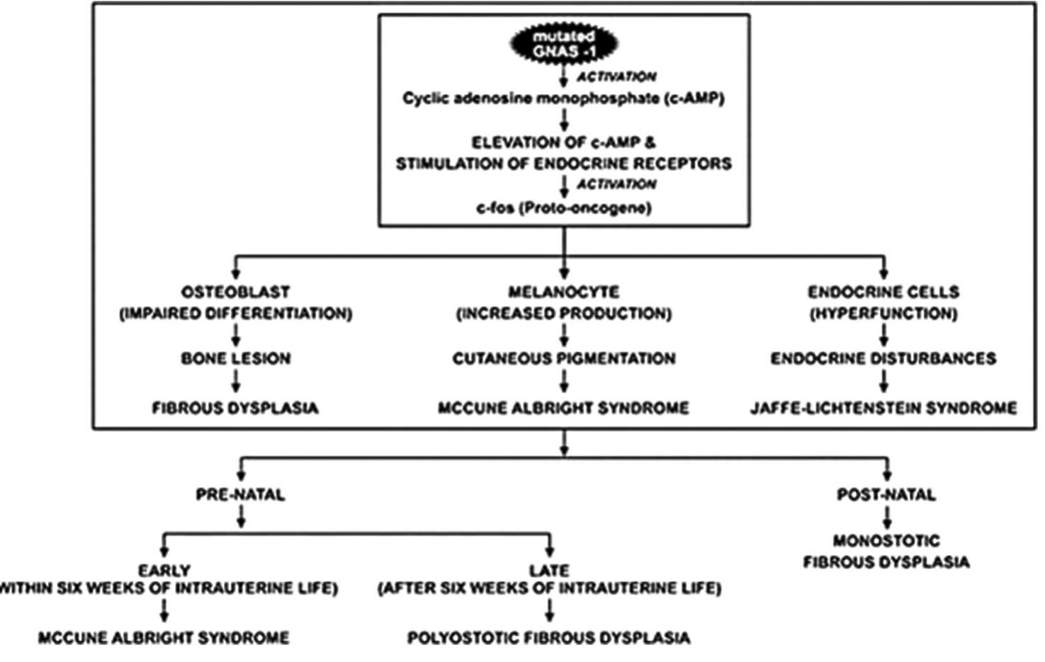Flowchart of pathogenesis of fibrous dysplasia radio-opaque