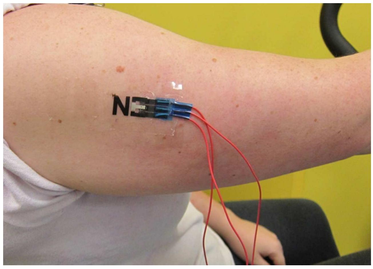 $1. photo of an epidermal lactate sensor interfaced with a