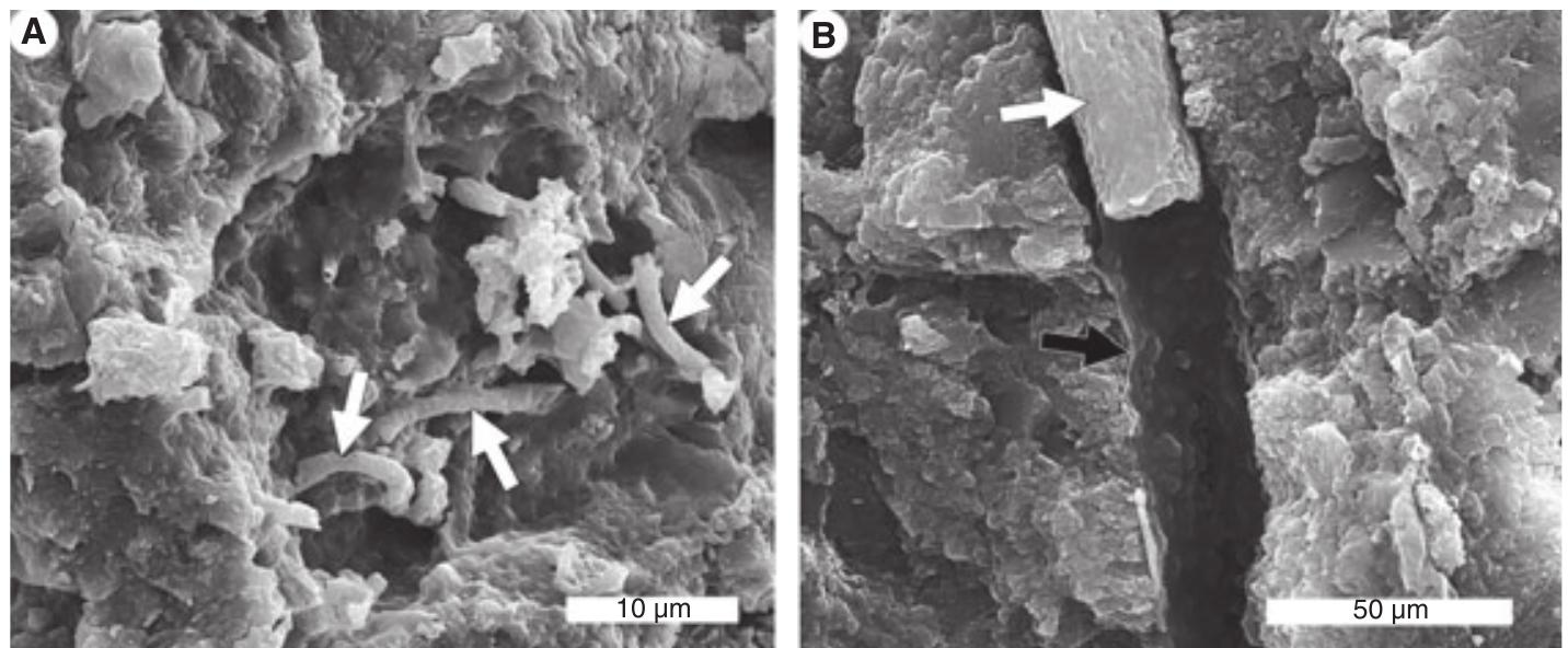 Scanning electron microscopy photomicrographs of filamentous